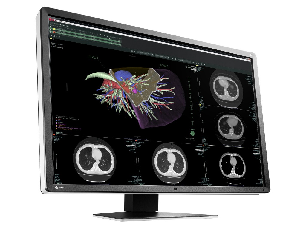 「Work-and-Flow」技術を搭載する30型ワイド医用ディスプレイ、EIZO「RadiForce RX660」 - エルミタージュ秋葉原