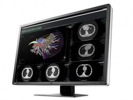 「Work-and-Flow」技術を搭載する30型ワイド医用ディスプレイ、EIZO「RadiForce RX660」 - エルミタージュ秋葉原